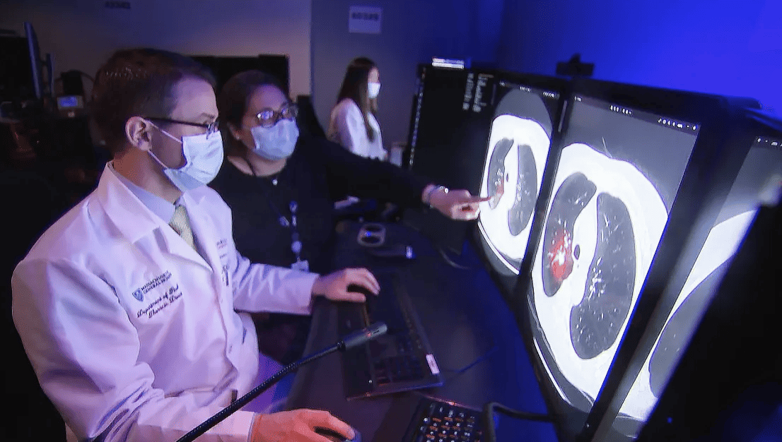 Une IA capable de détecter l'apparition future du cancer du poumon
