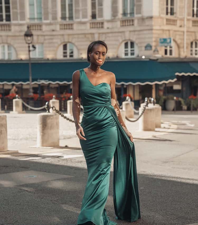 Miss France 2024: une candidate atteinte du vitiligo donne l’exemple